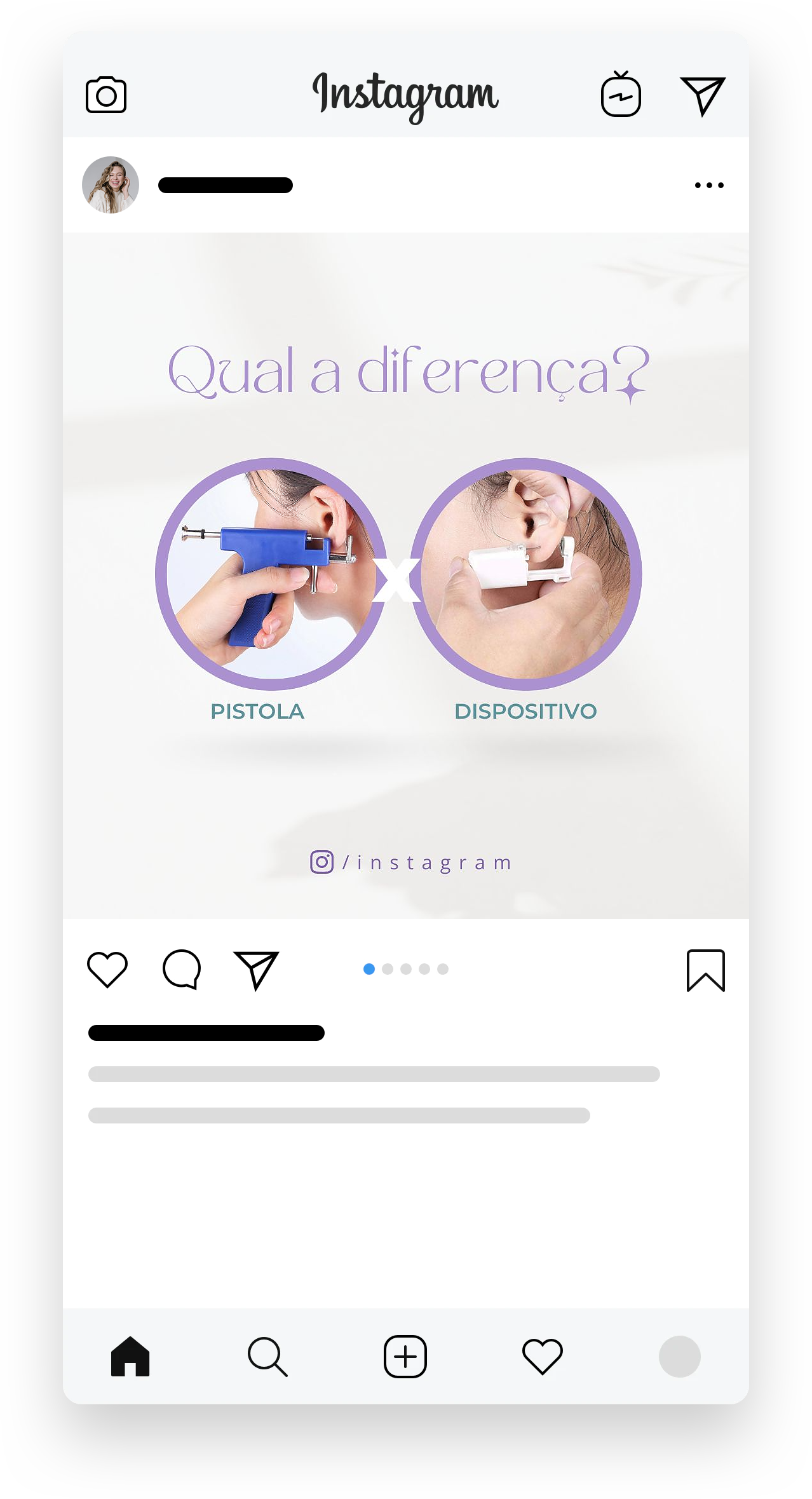 Pack Canva Furo Humanizado